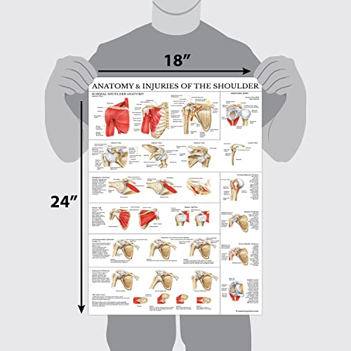 Palace Learning LAMINATED Anatomy and Injuries of the Shoulder Poster ...