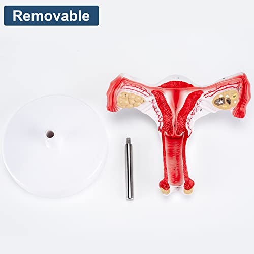 Winyousk Life-Size Uterus and Ovary Model, Anatomical Model of Female ...