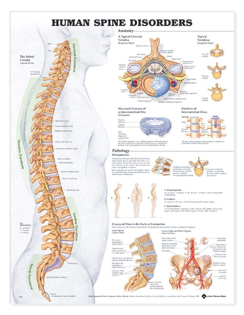 Anatomical Chart Company Human Spine Disorders Chart — 🛍️ The Retail Market