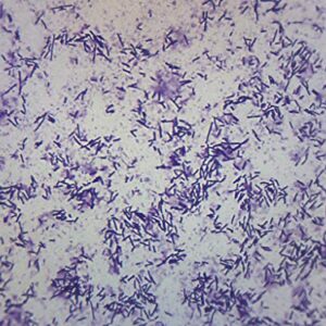 EISCO (Pack of 25) Escherichia Coli Smear, Gram Stain, Prepared ...