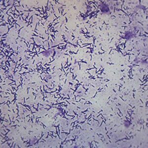 EISCO (Pack of 25) Escherichia Coli Smear, Gram Stain, Prepared ...