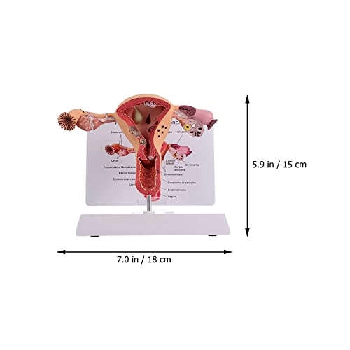 ROLTIN Human Pathological Uterus Model Internal Reproductive System ...